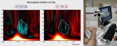 Laser Evoked Potentials (LEP) - AgliotiLAB